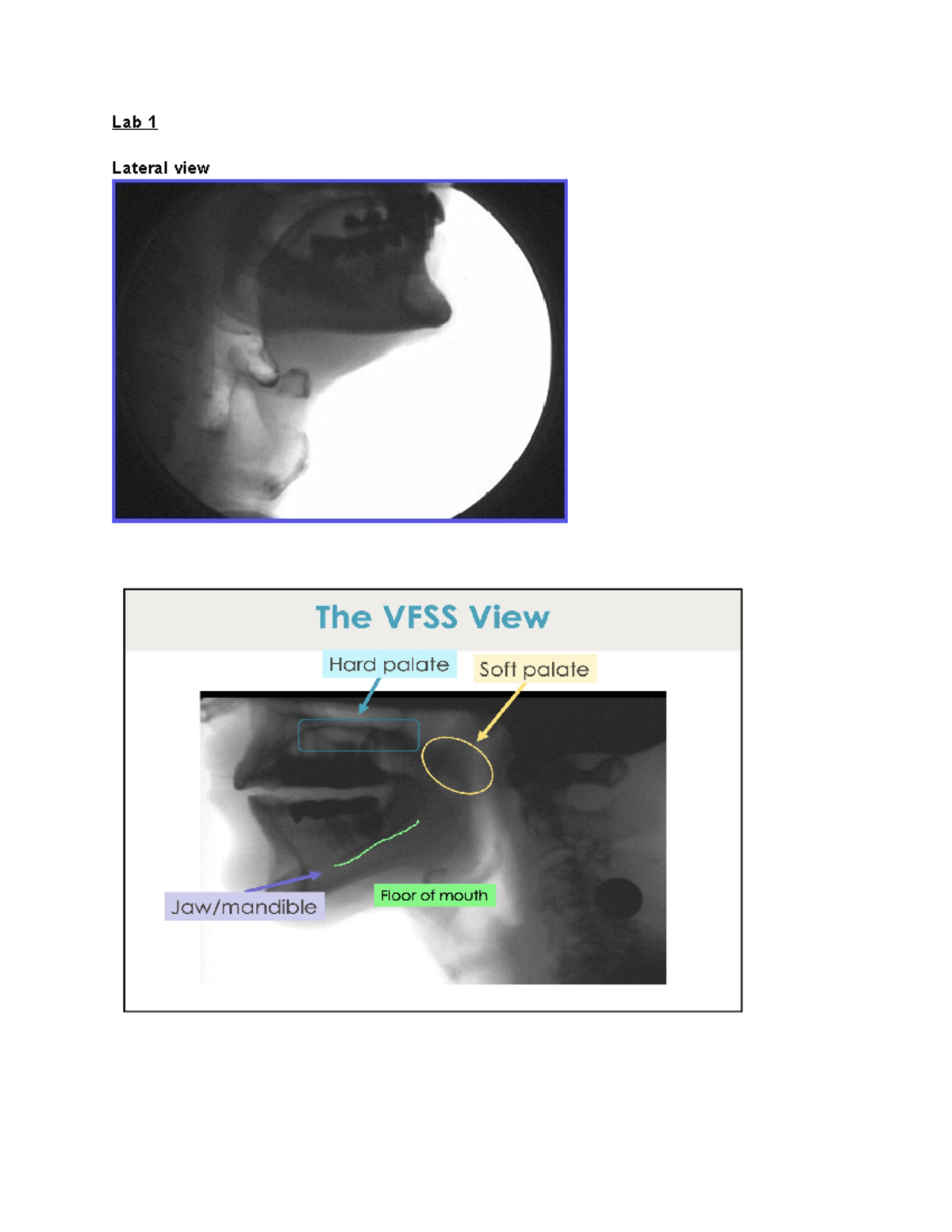 6055 Lab 1 - Examples of an MBS - Lab 1 Lateral view Anatomical Sights ...