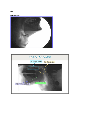 Visual for Swallowing, Cranial Nerves and Muscles - NerveMuscleMotor ...