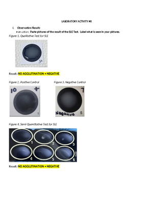 Act 9 iat - lab act - LABORATORY ACTIVITY I. Observation/Results Figure 1. No agglutination or ...