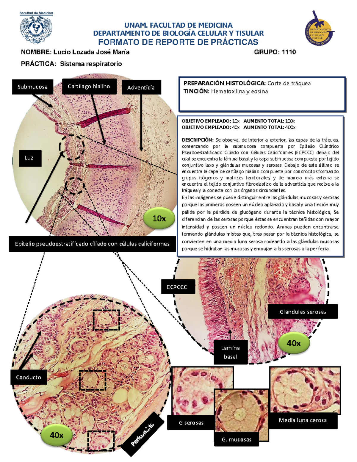 Se muestran cortes histológicos del sistema respiratorio humano. - UNAM ...