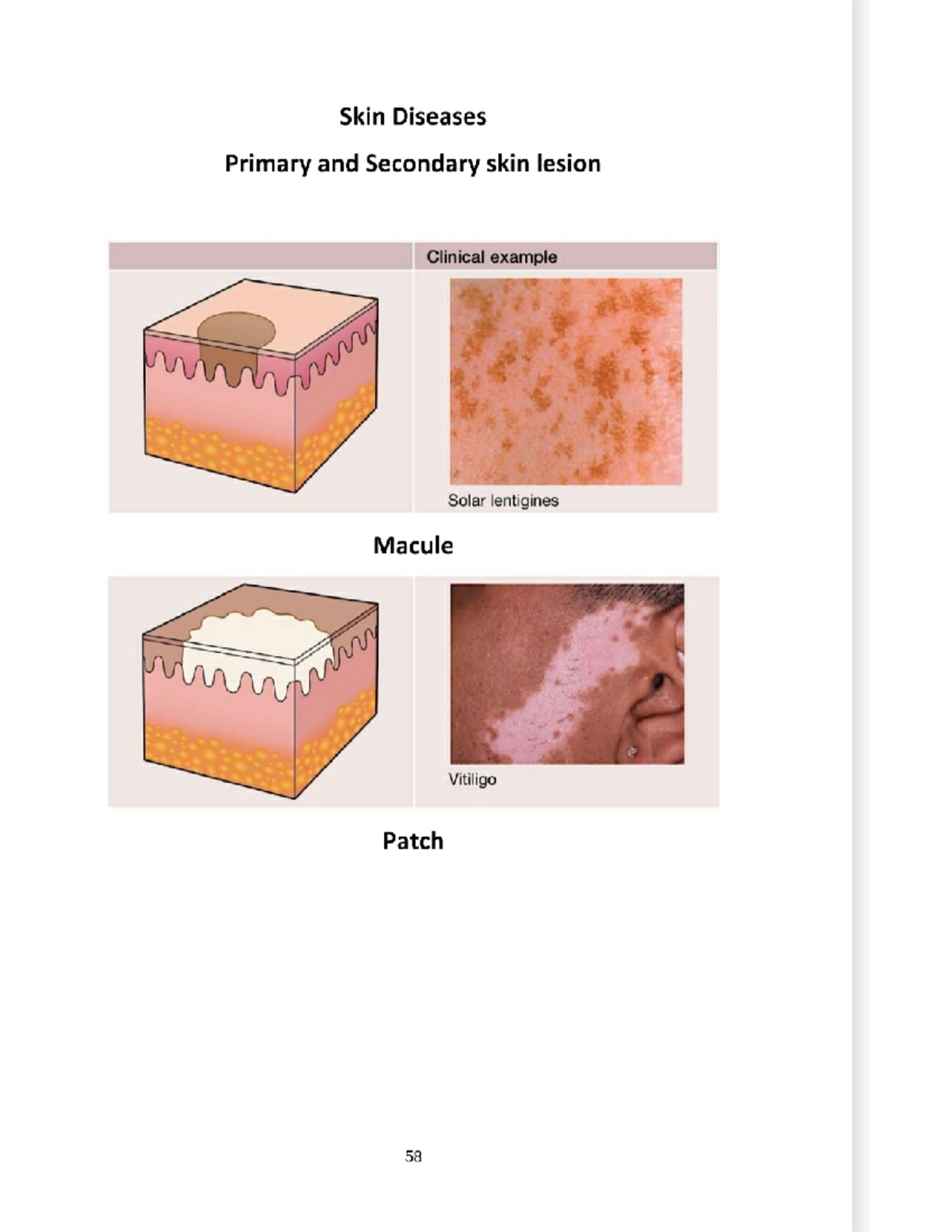 Skin diseases bacterial, fungal, viral - Dermatology & Reproduction ...