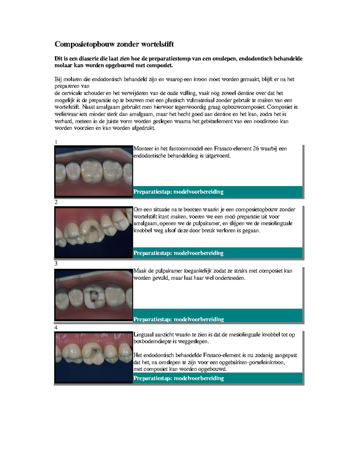 Composietopbouw zonder wortelstift - Bij molaren die endodontisch ...