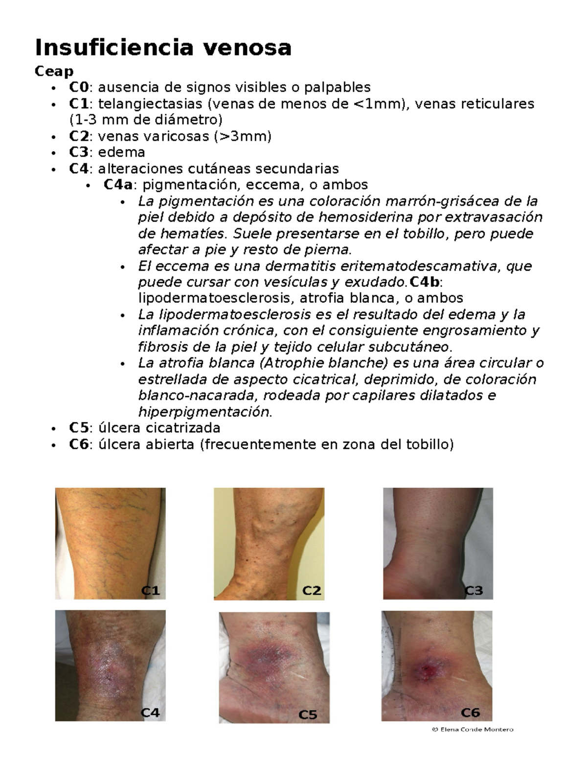 Insuficiencia venosa periférica - Insuficiencia venosa Ceap C0 ...