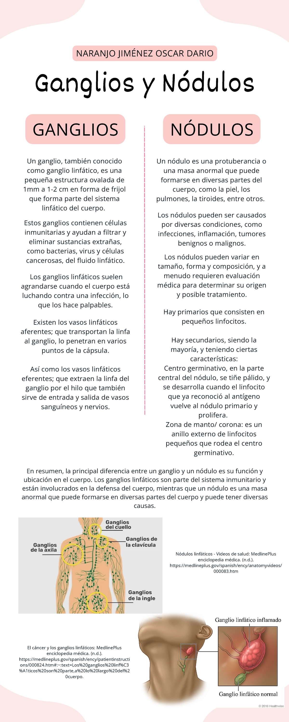 Ganglios y nódulos - NARANJO JIMÉNEZ OSCAR DARIO Ganglios y Nódulos Un ...