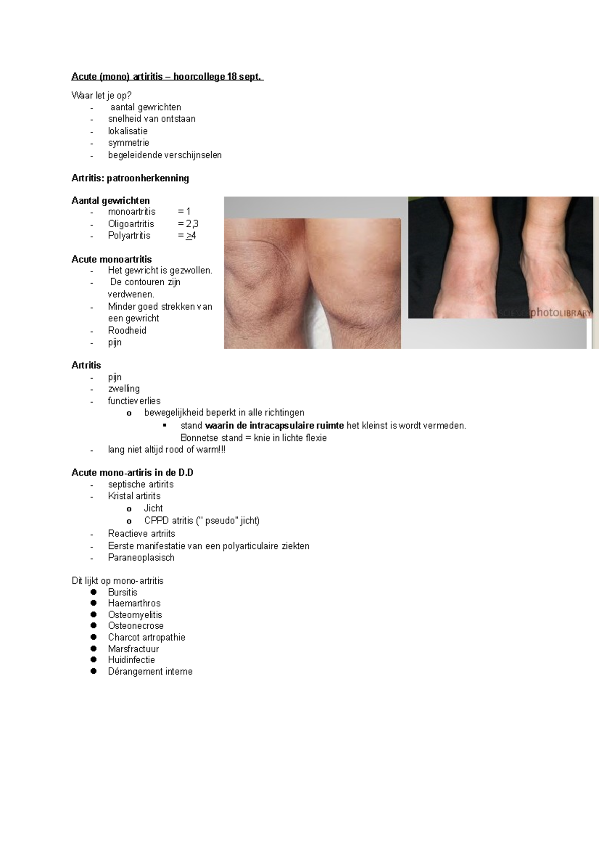 Acute (mono) artritis - 18 sept - Acute (mono) artiritis hoorcollege 18 ...