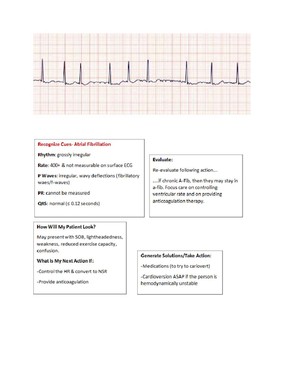 All+EKG+Strips - EKG rhythm - Nur 265 - Studocu