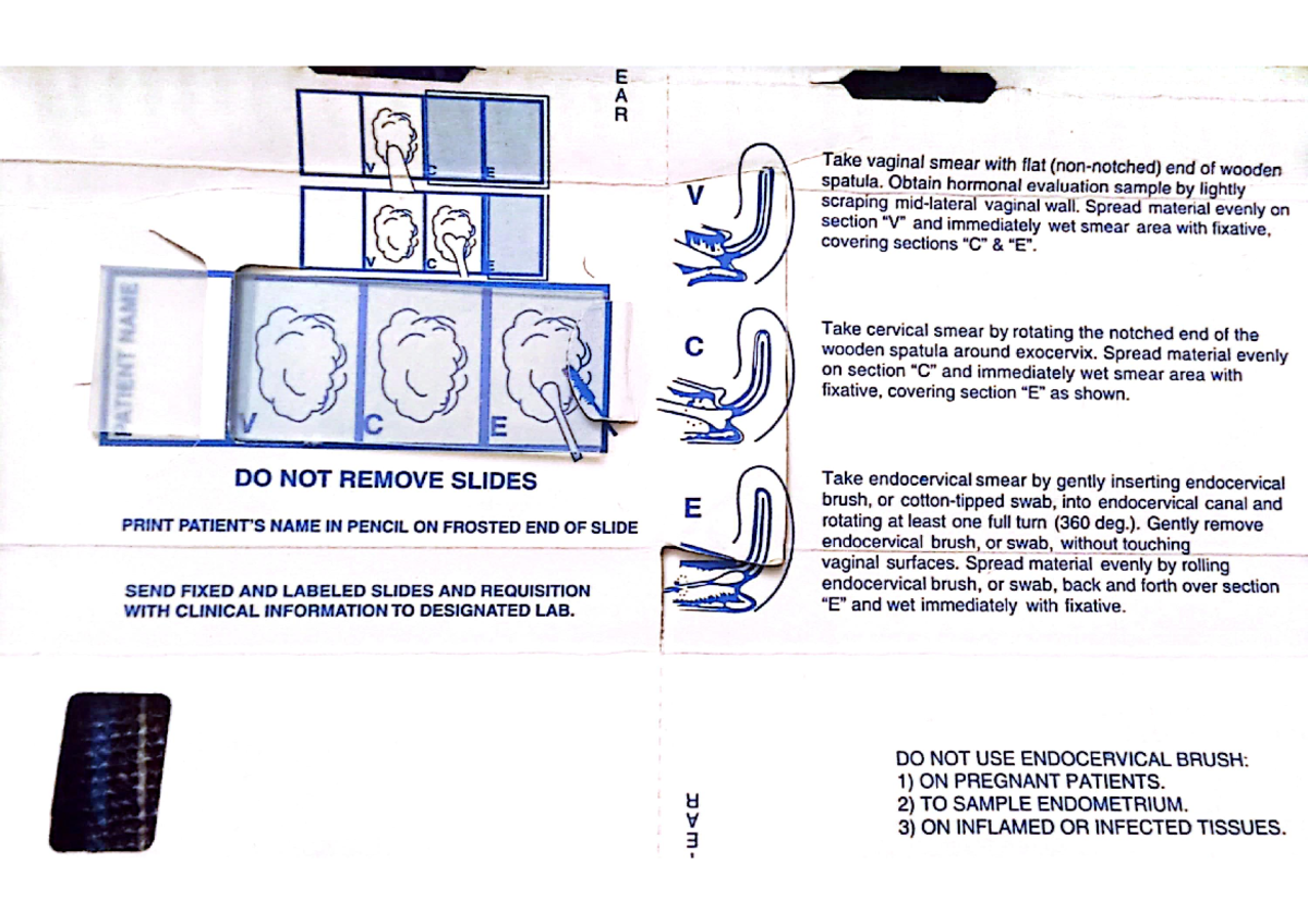 Pap Smear Kit and LEEP instruments images - E A R Take vaginal smear ...