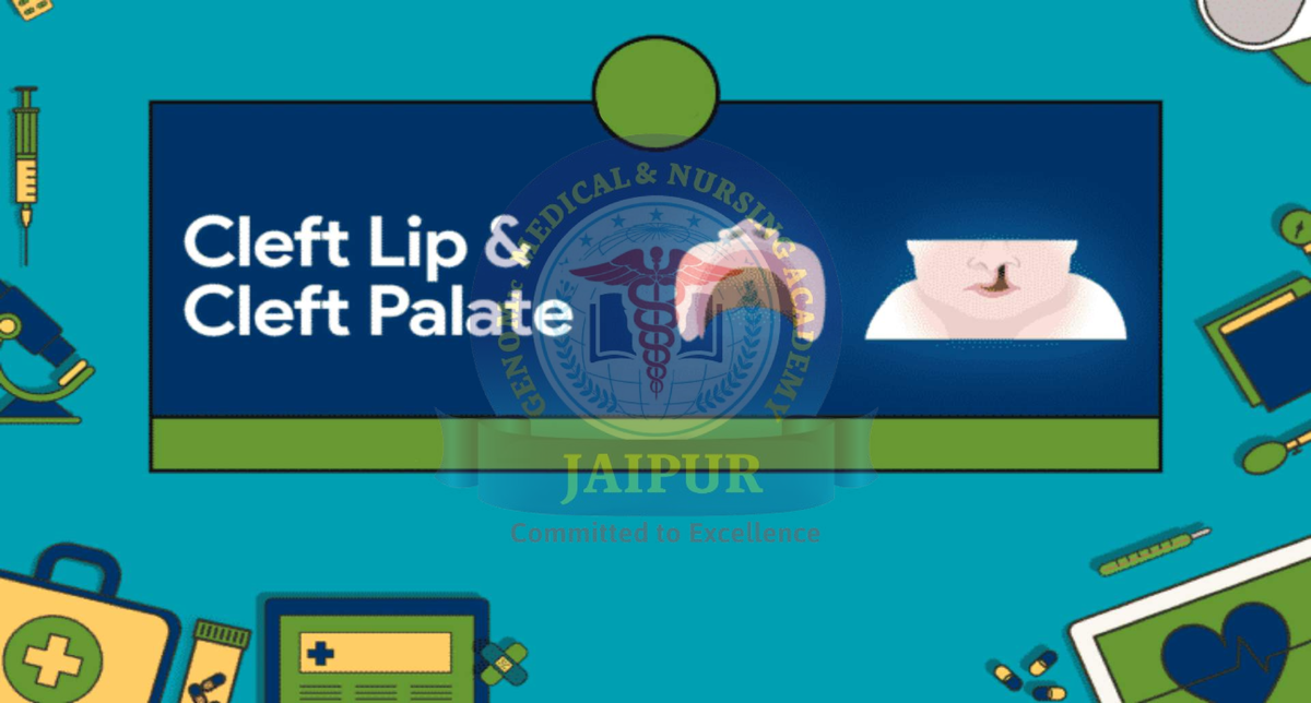 Cleft Lip & Cleft Palate notes - Nursing - Studocu