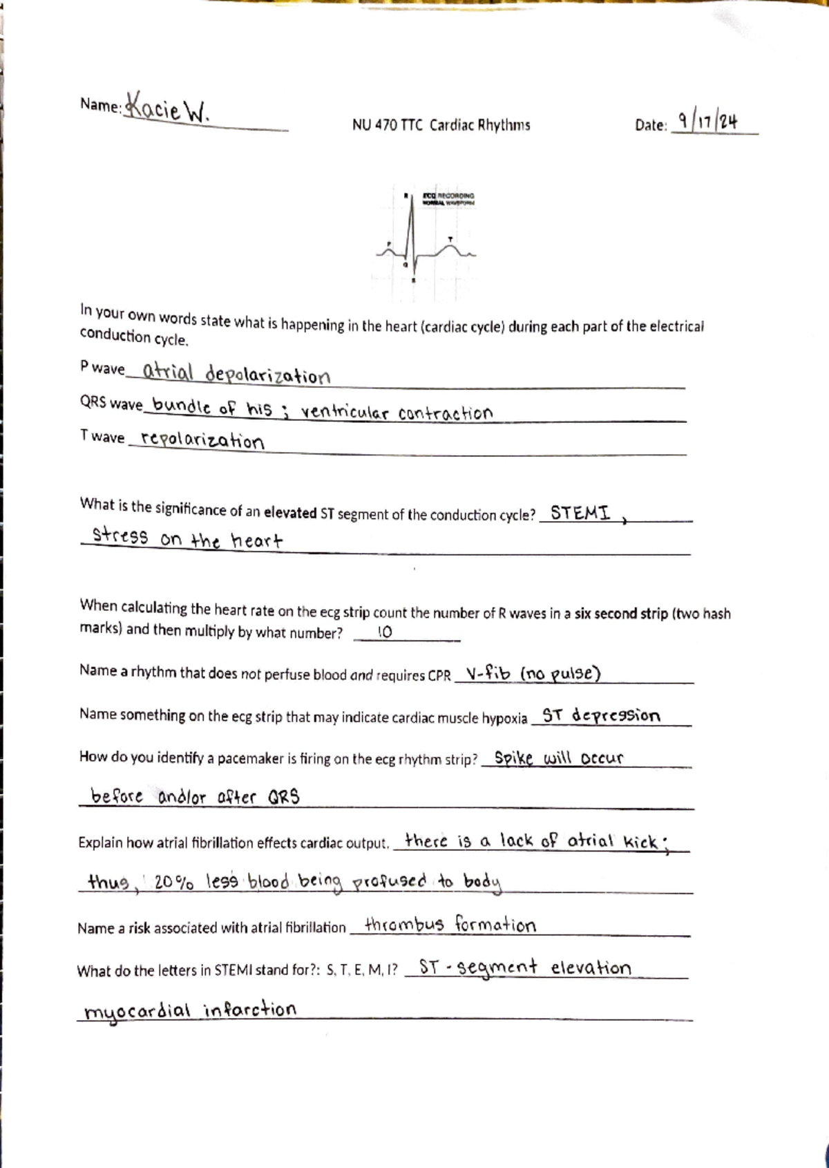 TTC cardiac rhythms - TTC adult health - i Name:.Ko.,e .J. NU 470 ...