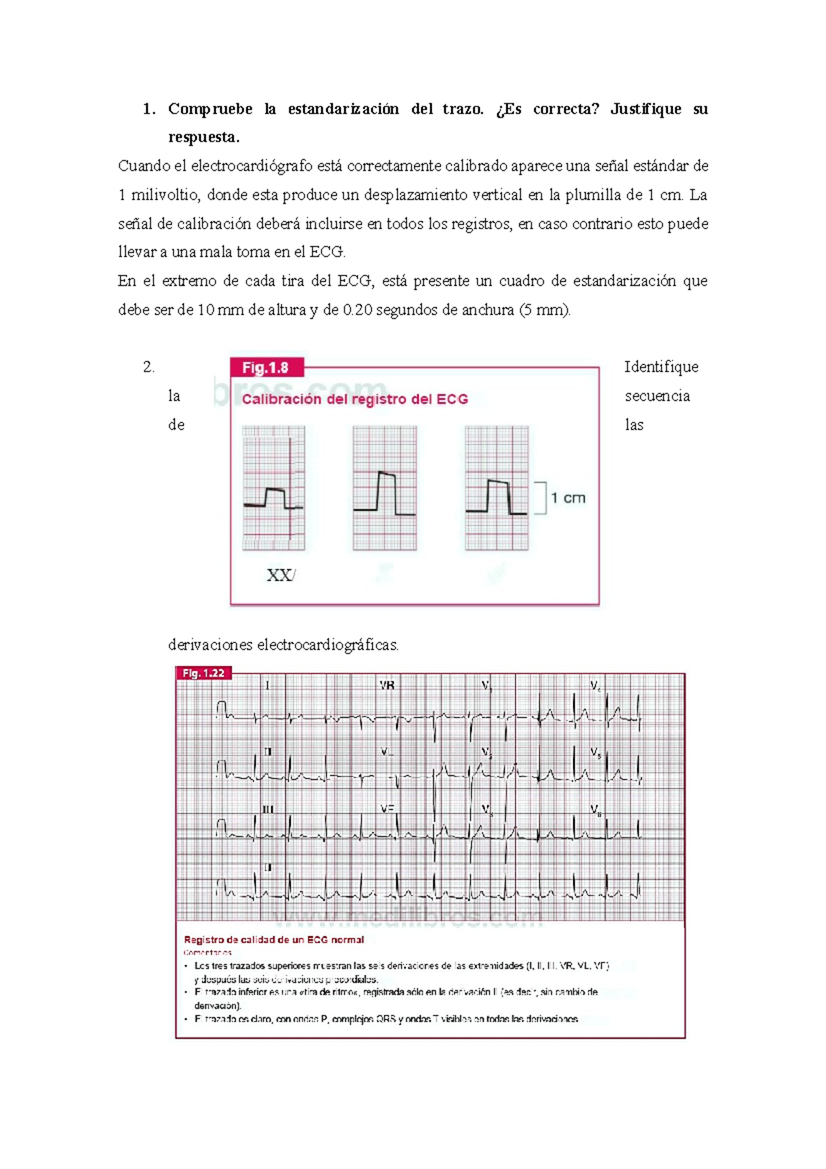 ECG- Guía 1 - Guía de electrocardiograma básico - 1. Compruebe la ...