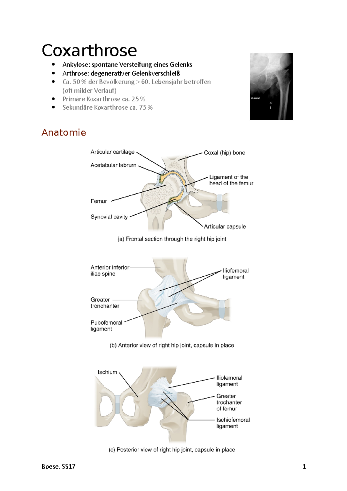 Coxarthrose - Übungen - Coxarthrose Ankylose: spontane Versteifung ...