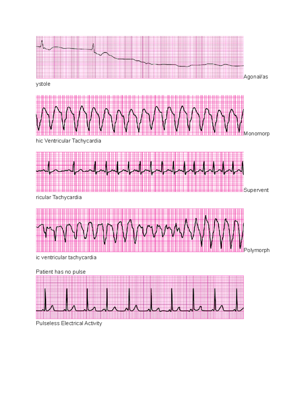 Acls Pretest Answers 2024 Acls Pretest And Answers