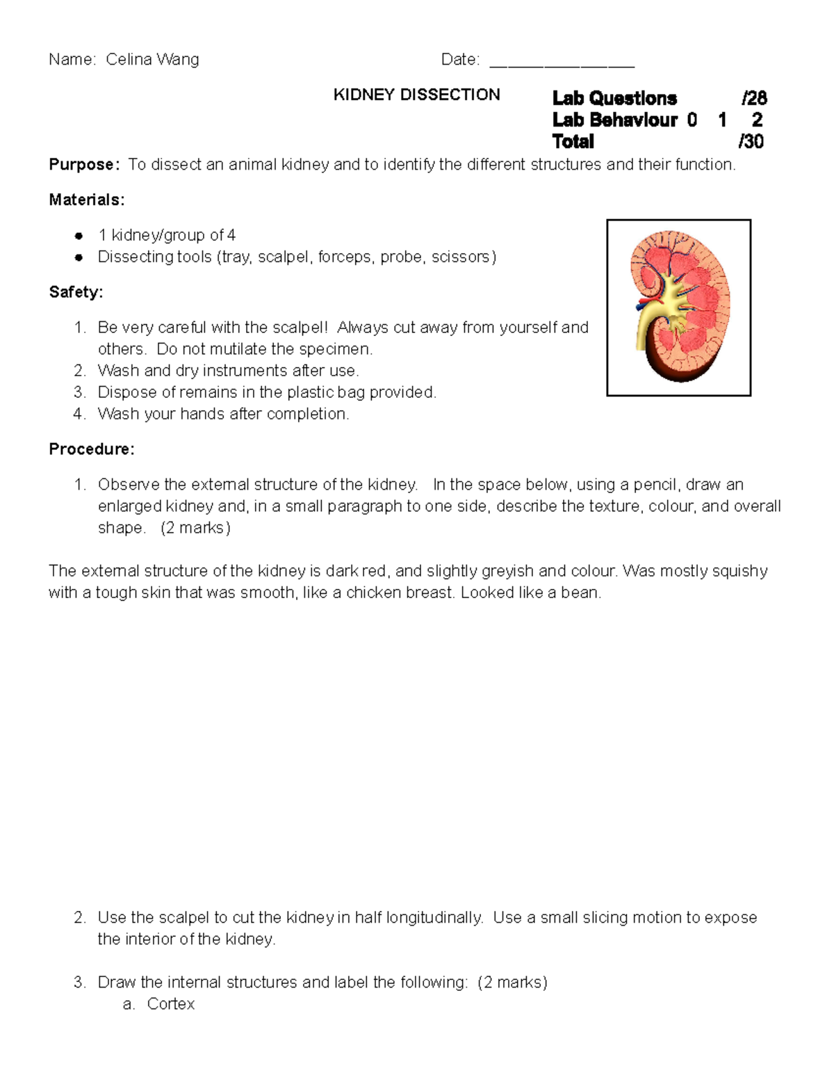 Kidney Dissection 2022 - Google Docs - Name: Celina Wang Date ...