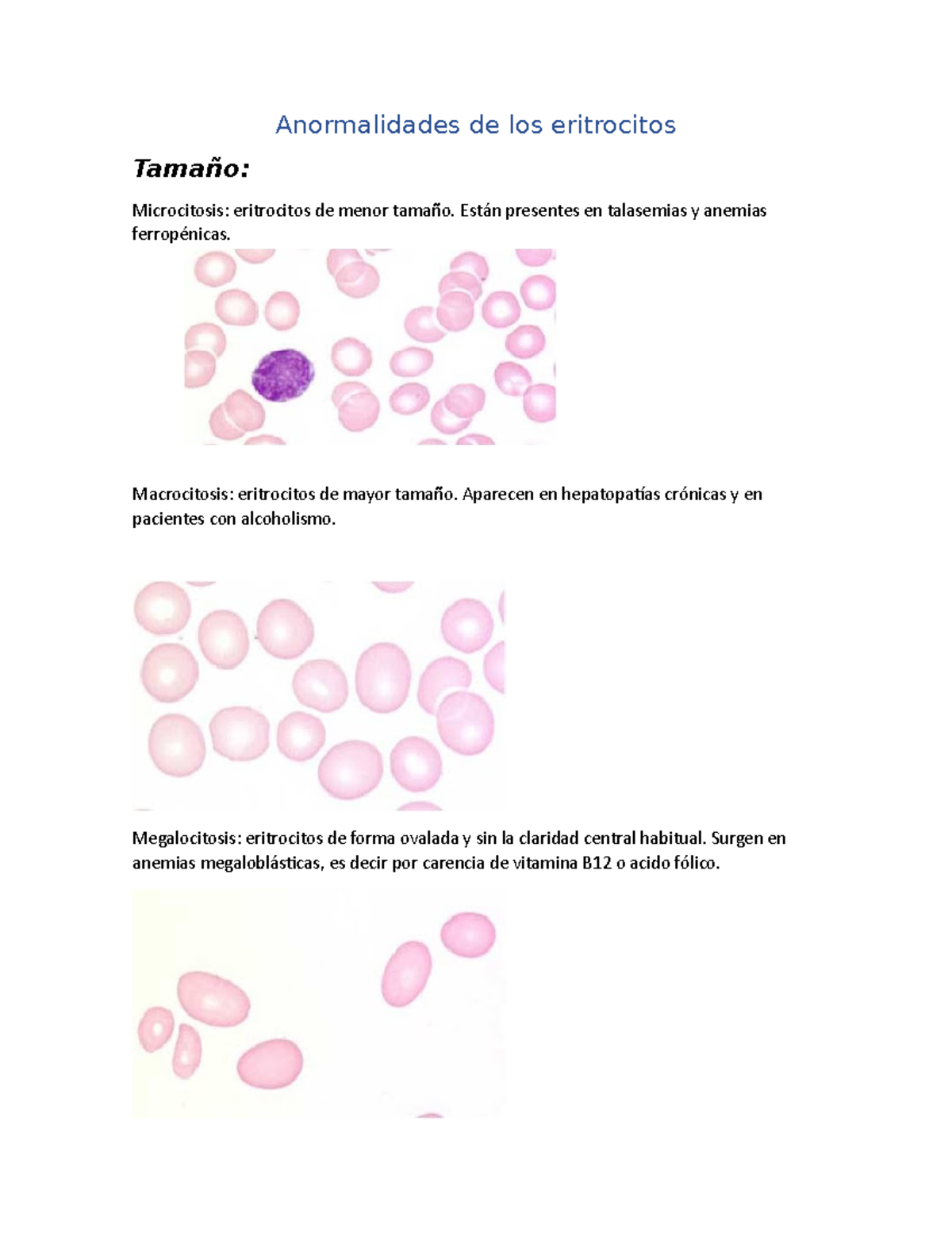 Anormalidades de los eritrocitos - Megalocitosis: eritrocitos de forma ...