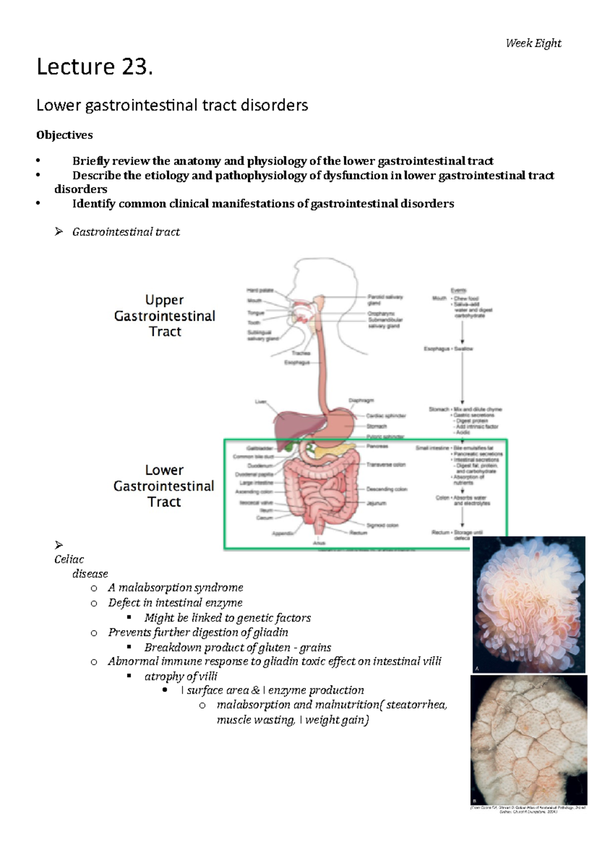 HUBS2505 Lecture 23 - Summary Notes - Lecture 23. Lower ...