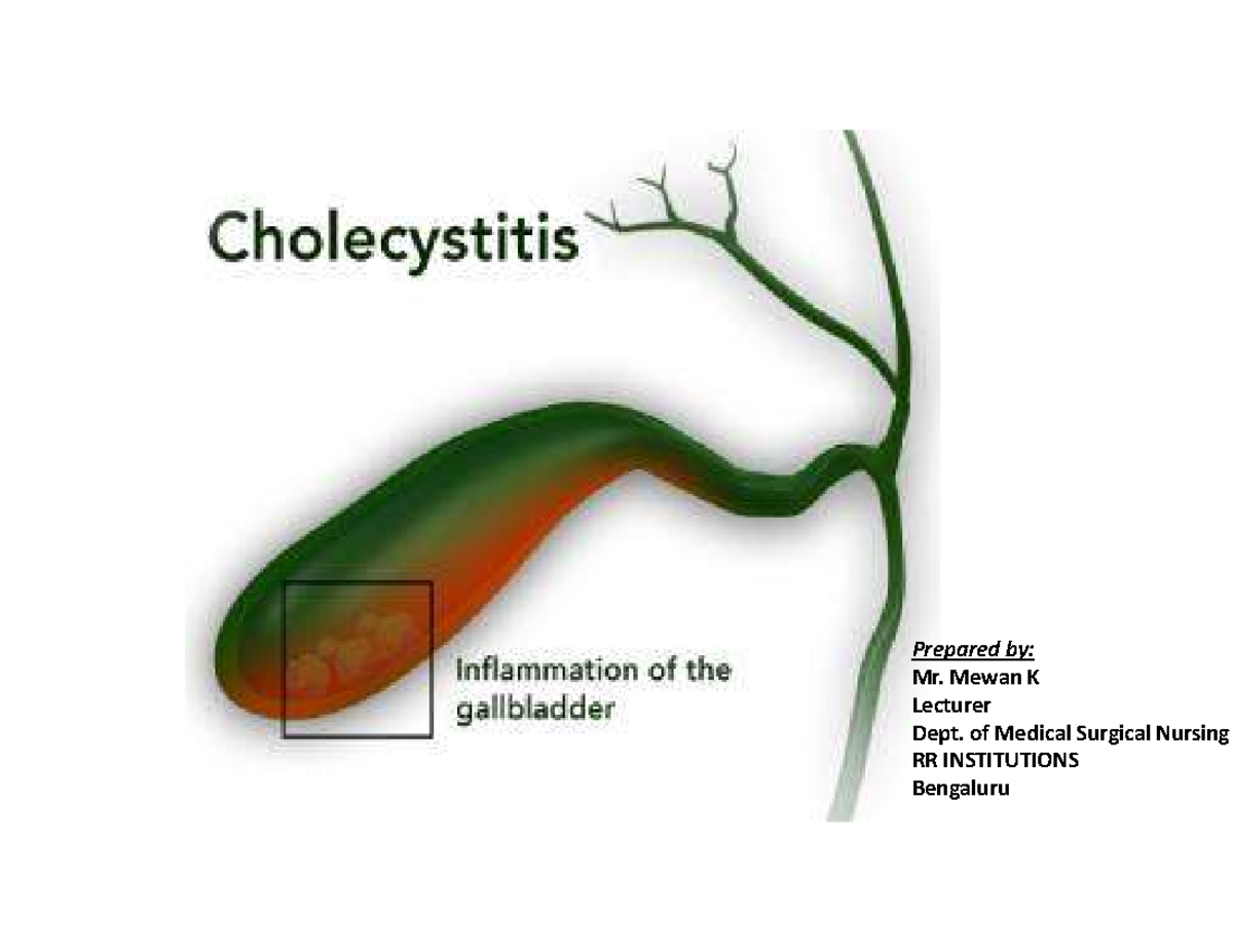 Cholecystitis - ####### Prepared by: ####### Mr. Mewan K ...