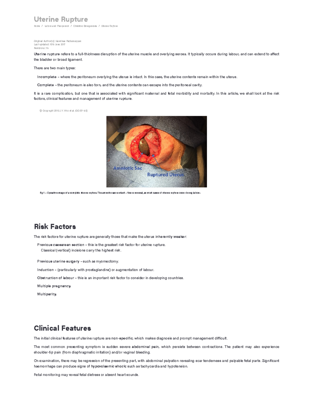Uterine Rupture - Risk Factors - Management - Surgery - Teach Me Ob Gyn ...