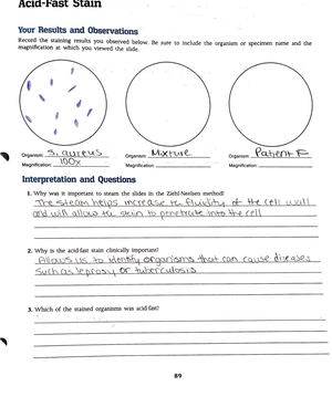 Isolation Plate Lab - Isolation Streak Plate Your Results and Ob ...