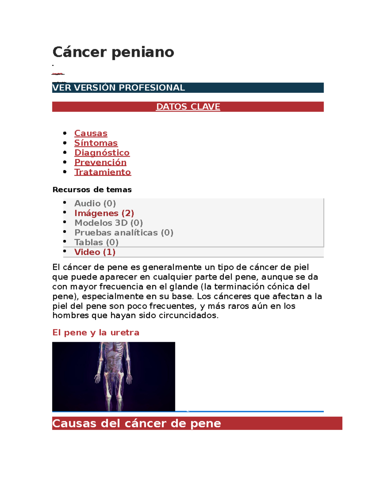 Cáncer peniano - El cáncer de pene puede ser debido a una irritación ...
