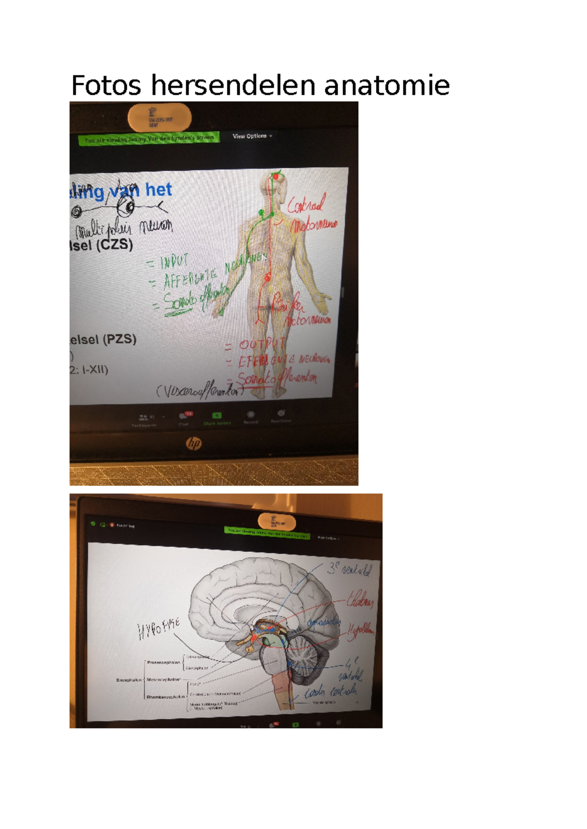 Fotos hersendelen anatomie - V. - Zenuwcellichamen - Vnl. t.h. cortex ...