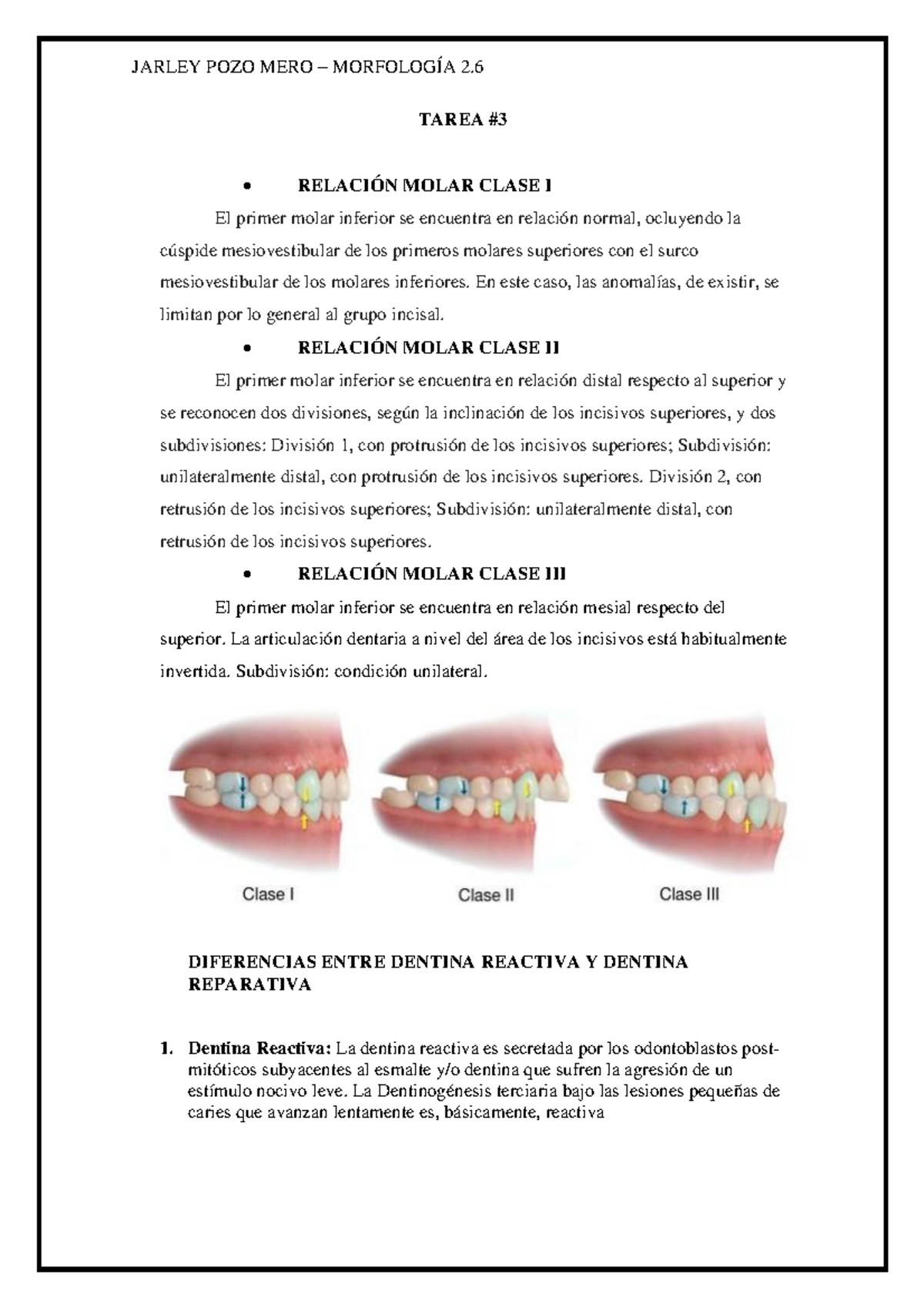 Tkm Sebitas - Cristhian Villamar - JARLEY POZO MERO – MORFOLOGÍA 2 ...