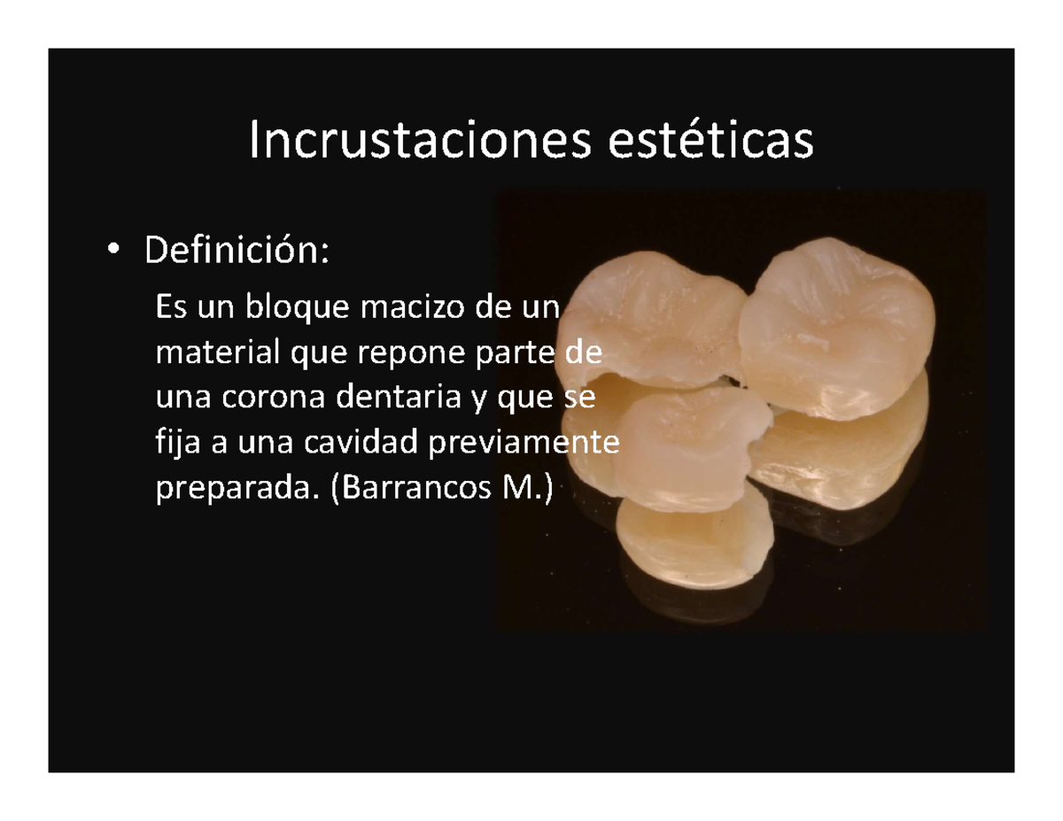 C Incrustaciones estéticas Materiales D - Incrustaciones estéticas ...