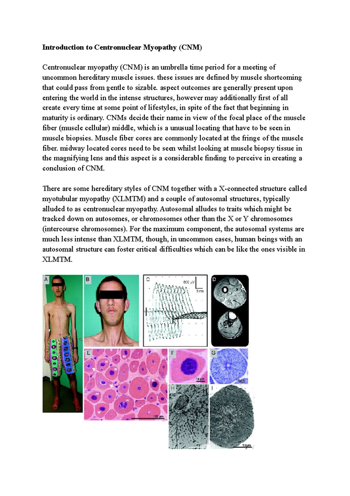Differential Diagnosis of Centronuclear Myopathy - Introduction to Centronuclear Myopathy (CNM ...
