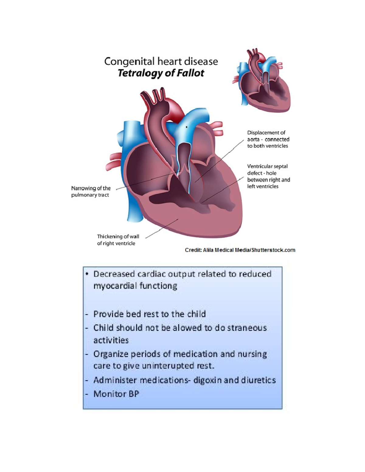 Pediatric heart conditions BA - Tet Spell Activity: Crying, screaming ...