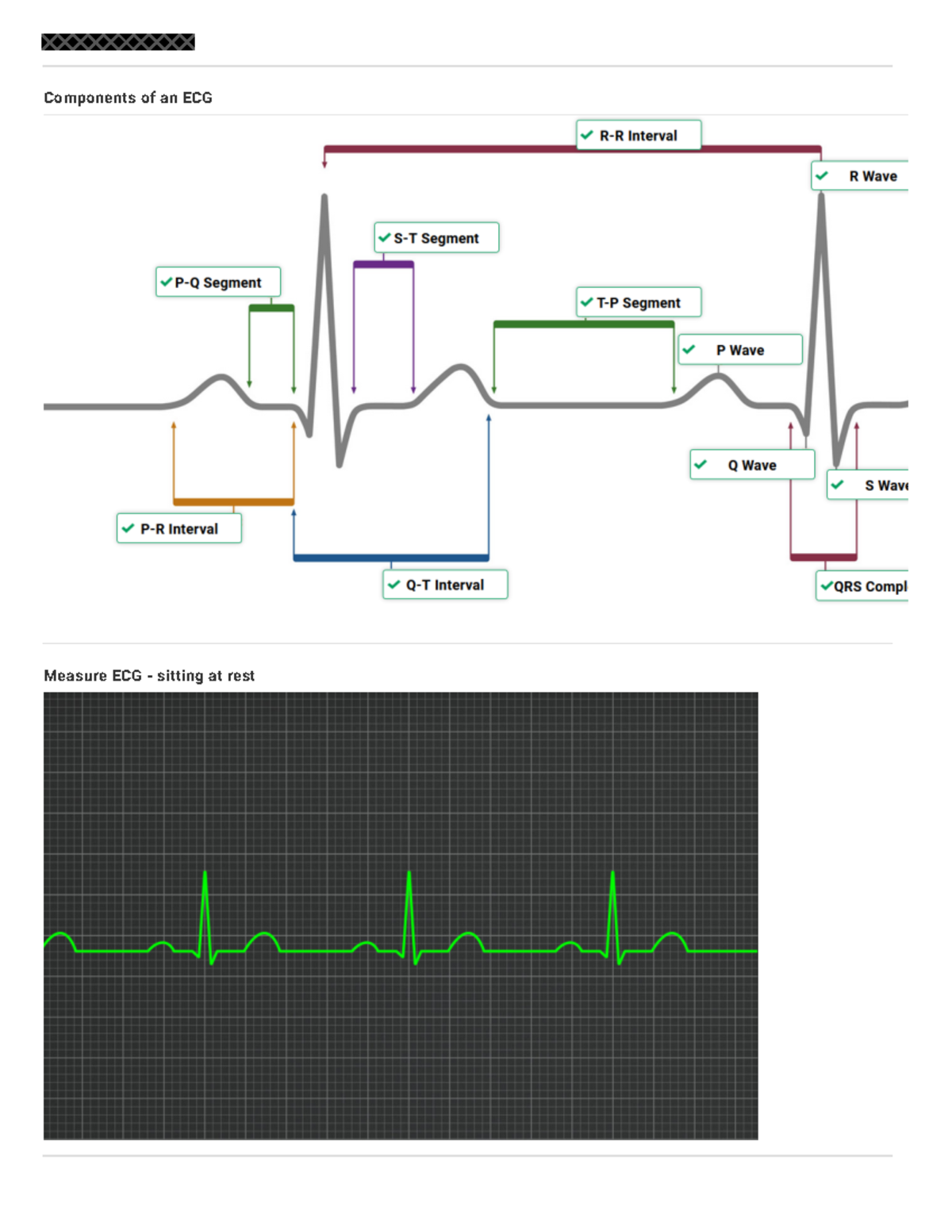 Electrocardiography Lab - Components of an ECG Measure ECG - sitting at ...