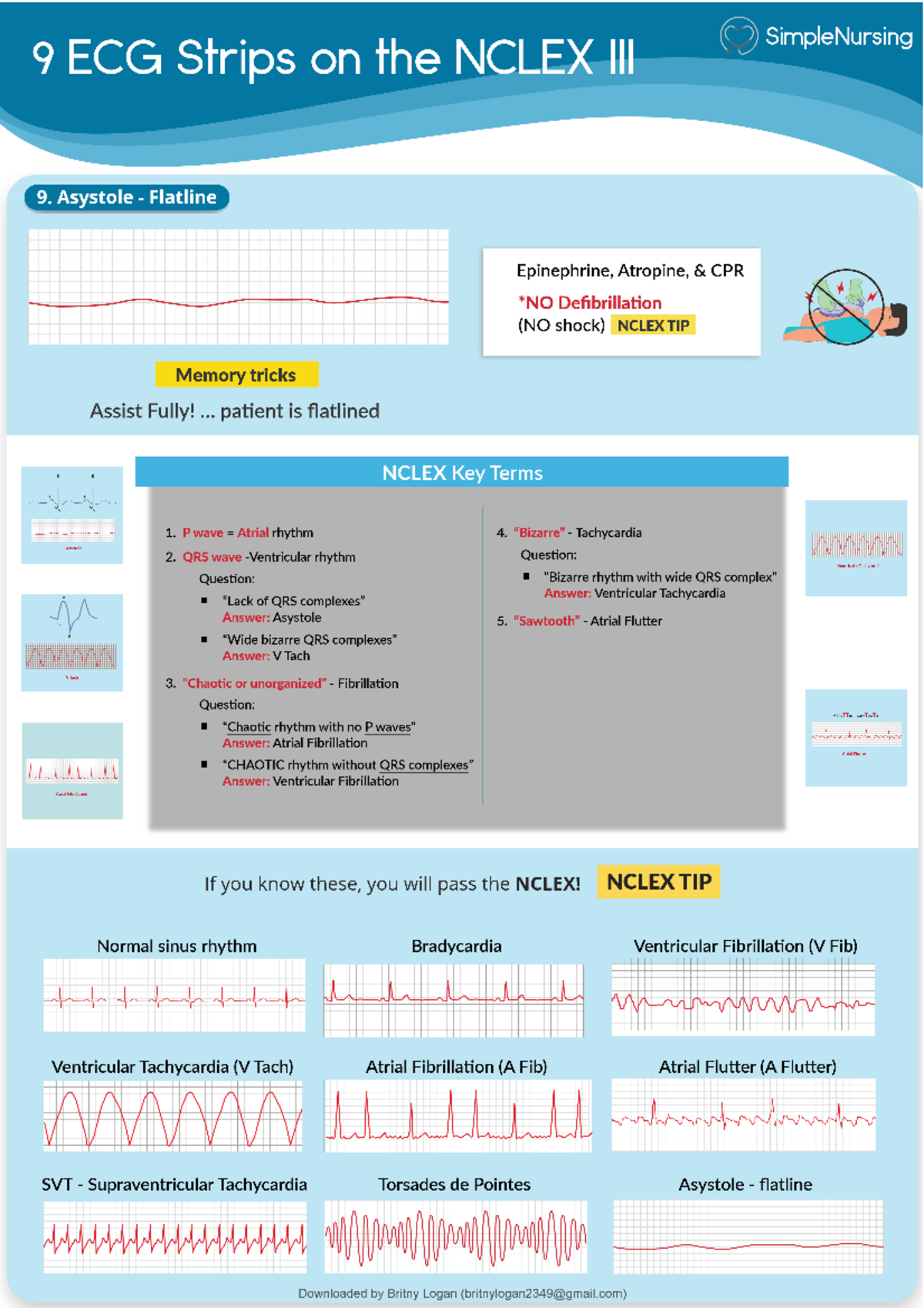 Ecg strips on the nclex - chart - NSG 122 - Studocu