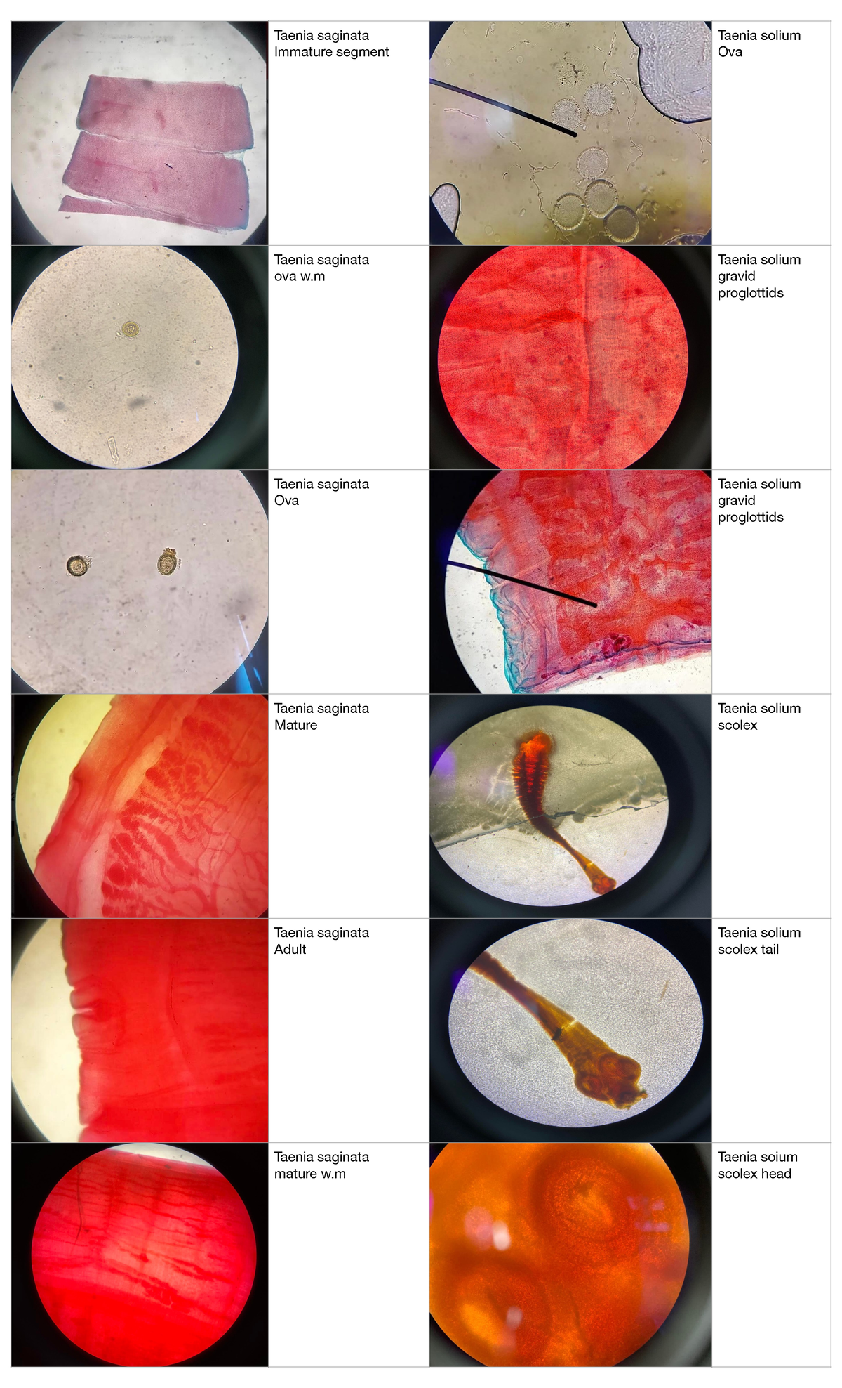 Parasitology Laboratory Pictures - Taenia saginata Immature segment ...
