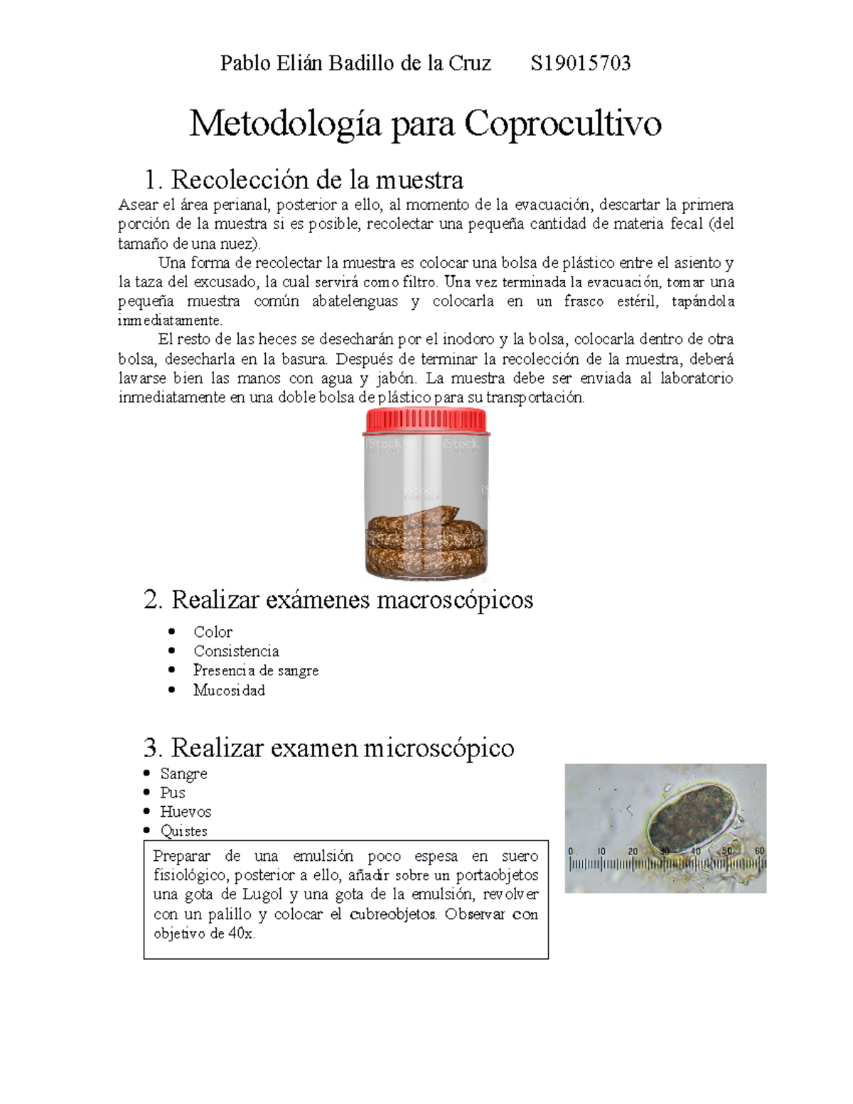 Metodología para Coprocultivo - Recolección de la muestra Asear el área perianal, posterior a ...