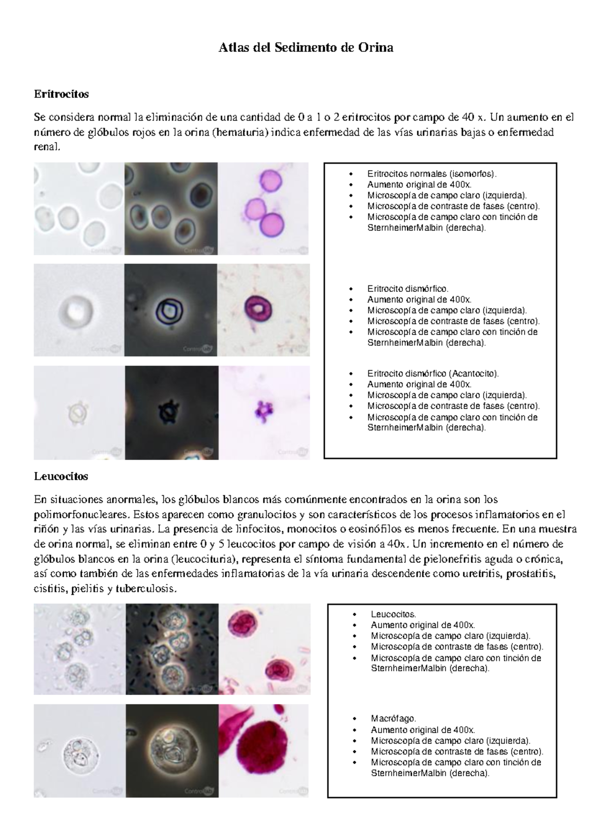 Atlas de sedimento urinario - Atlas del Sedimento de Orina Eritrocitos ...