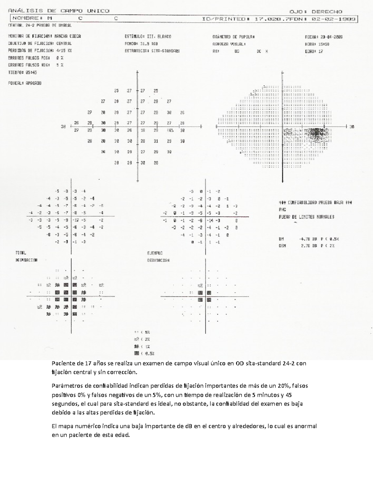 Campo visual ejemplo - CVC - Paciente de 17 años se realiza un examen ...