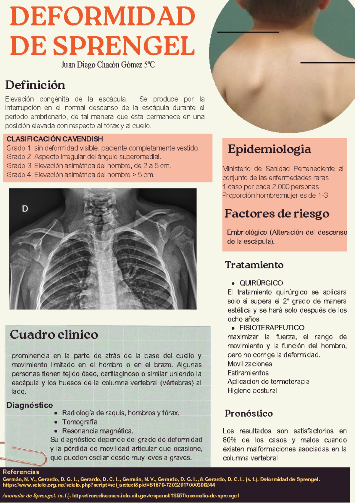 Deformidad de sprengel - DEFORMIDAD DE SPRENGEL Referencias Germán, N ...