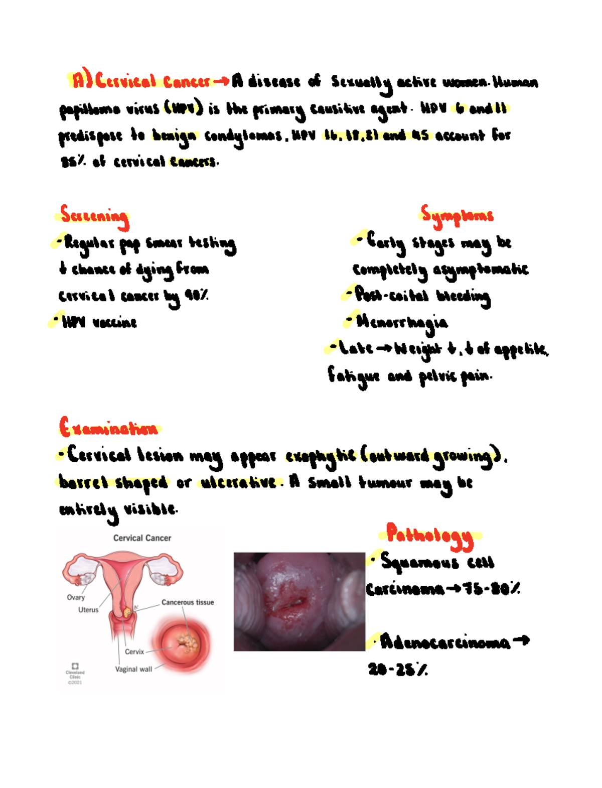 Cervical cancer - Pathophysiology, presentation, diagnosis, clinical ...