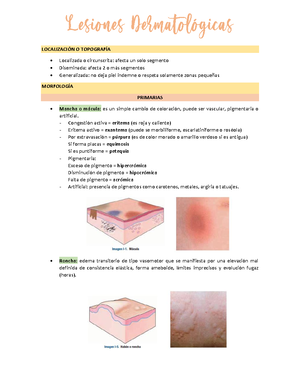 Fotodermias Lopez Velazquez Ana - FOTODERMIAS SinÛnimos: Prurigo solar ...
