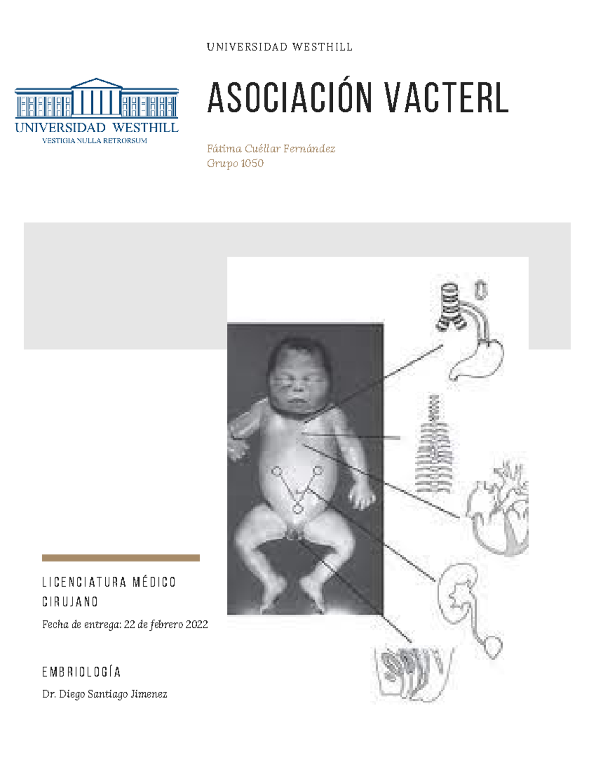 Asociación vacterl - U N I V E R S I D A D W E S T H I L L A S O C I A ...