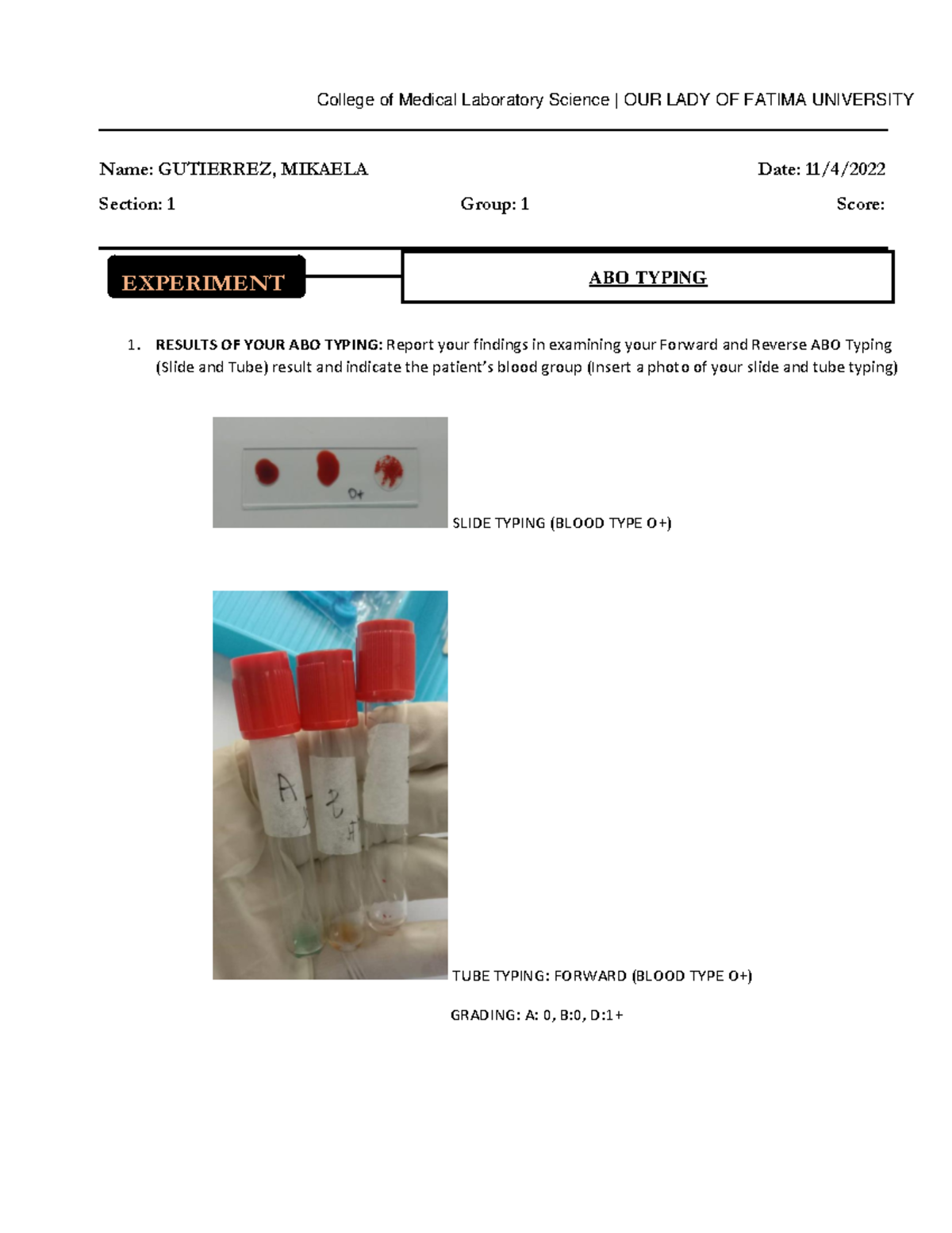 Gutierrez ABO Typing - ASSIGNMENT - College of Medical Laboratory ...