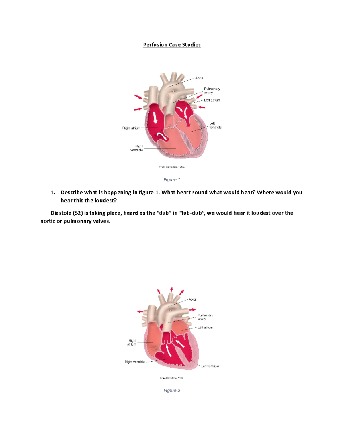 NUR 229 Perfusion Case Studies 2022 - Class Practice - Perfusion Case ...