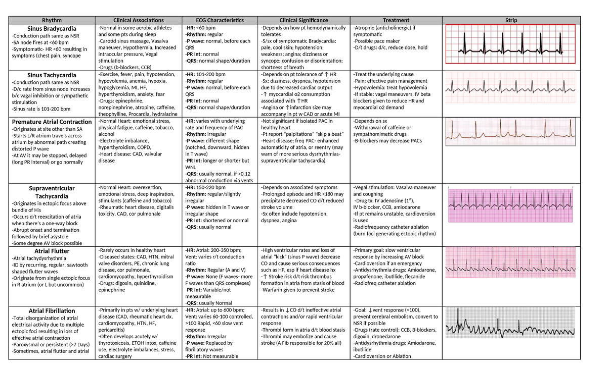 Heart notes strip - Rhythm Clinical Associations ECG Characteristics ...