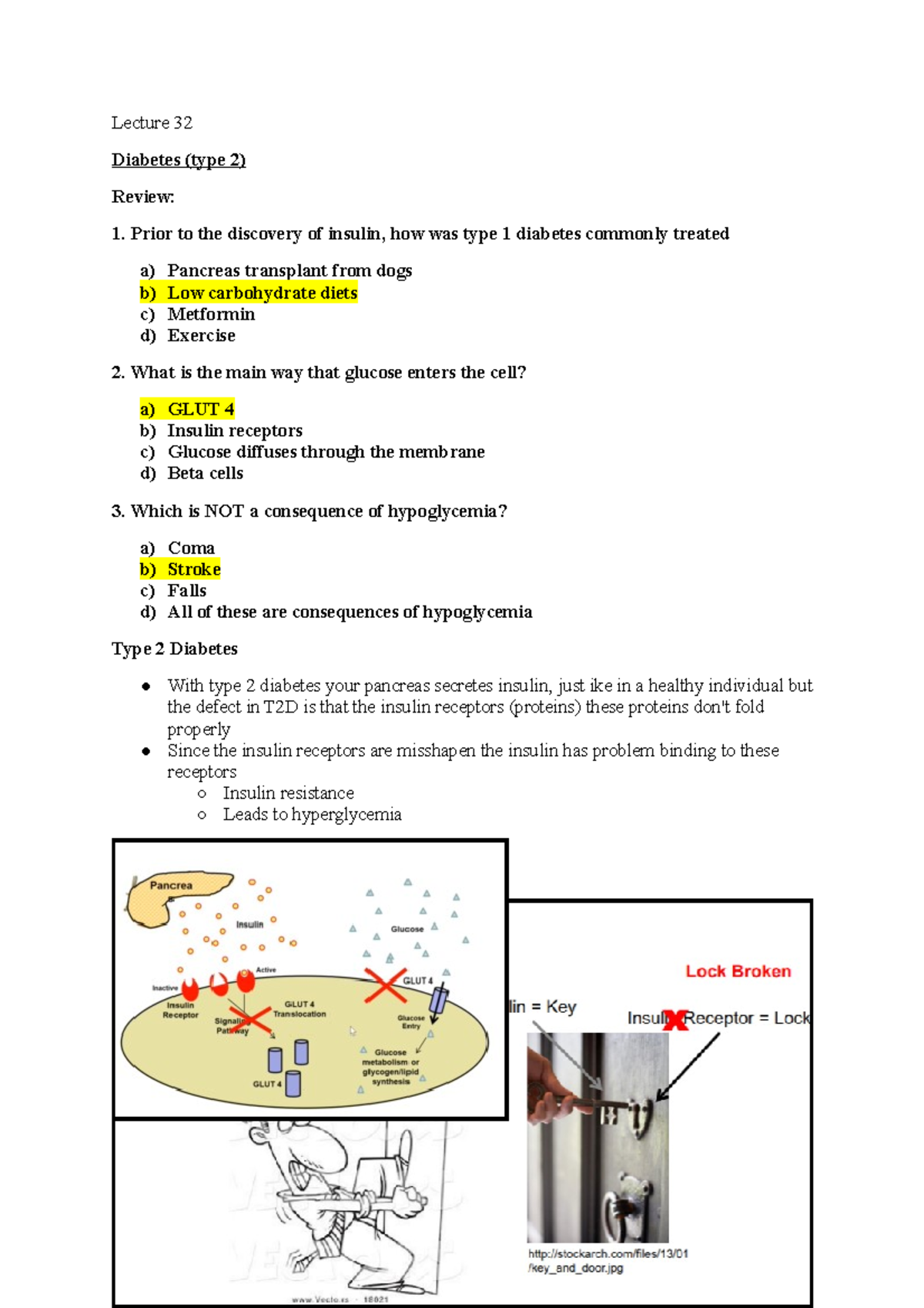 Diabetes (type 2) - Lecture 32 Diabetes (type 2) Review: Prior to the ...