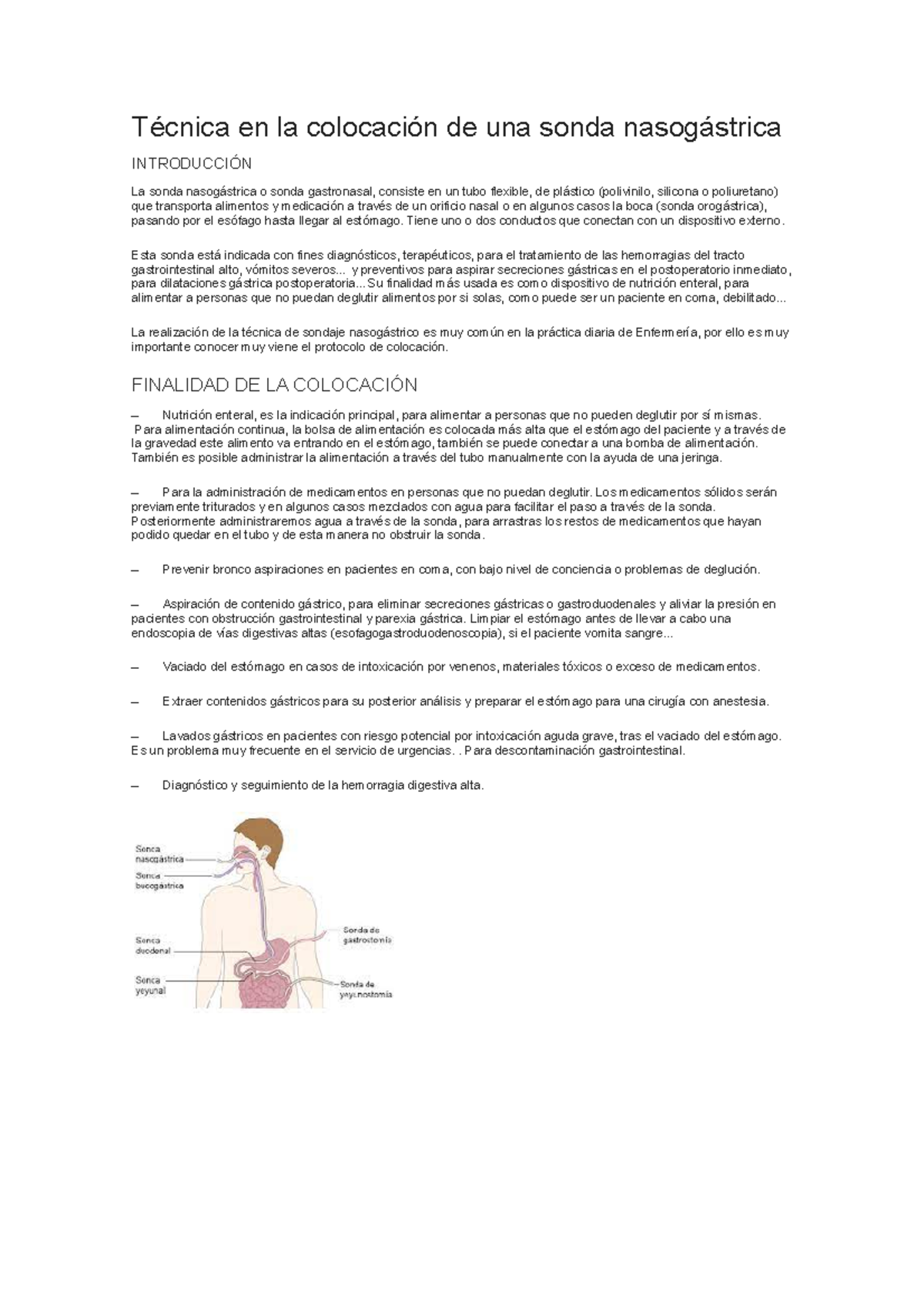 Técnica en la colocación de una SN - Técnica en la colocación de una ...