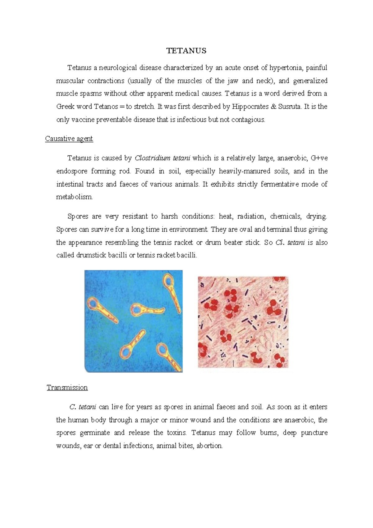 Tetanus - Notes for microbiology - TETANUS Tetanus a neurological ...