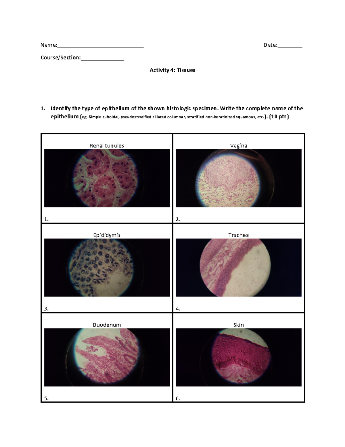 Activity 4 Tissues - Human Anatomy and Physiology - Warning: TT: undefined function: 32 - Studocu