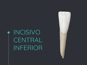 RESUMEN ANATOMÍA DENTAL Canino inferior - FACULTAD: ODONTOLOGÍA ...