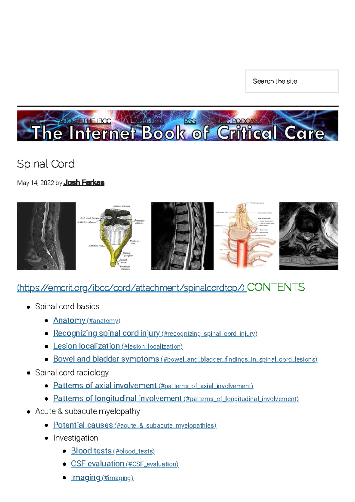 Spinal Cord - EMCrit Project - Search the site ... Spinal Cord May 14 ...