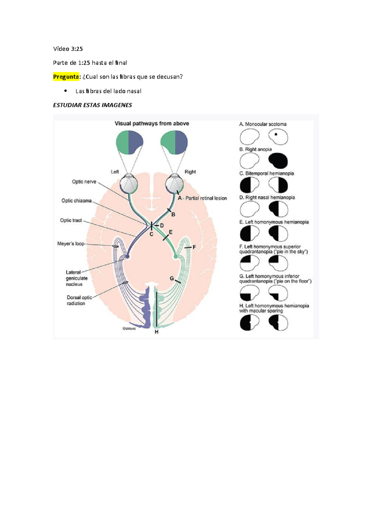 VIA Visual Apuntes 1 - Video 3: Parte de 1:25 hasta el final Pregunta ...
