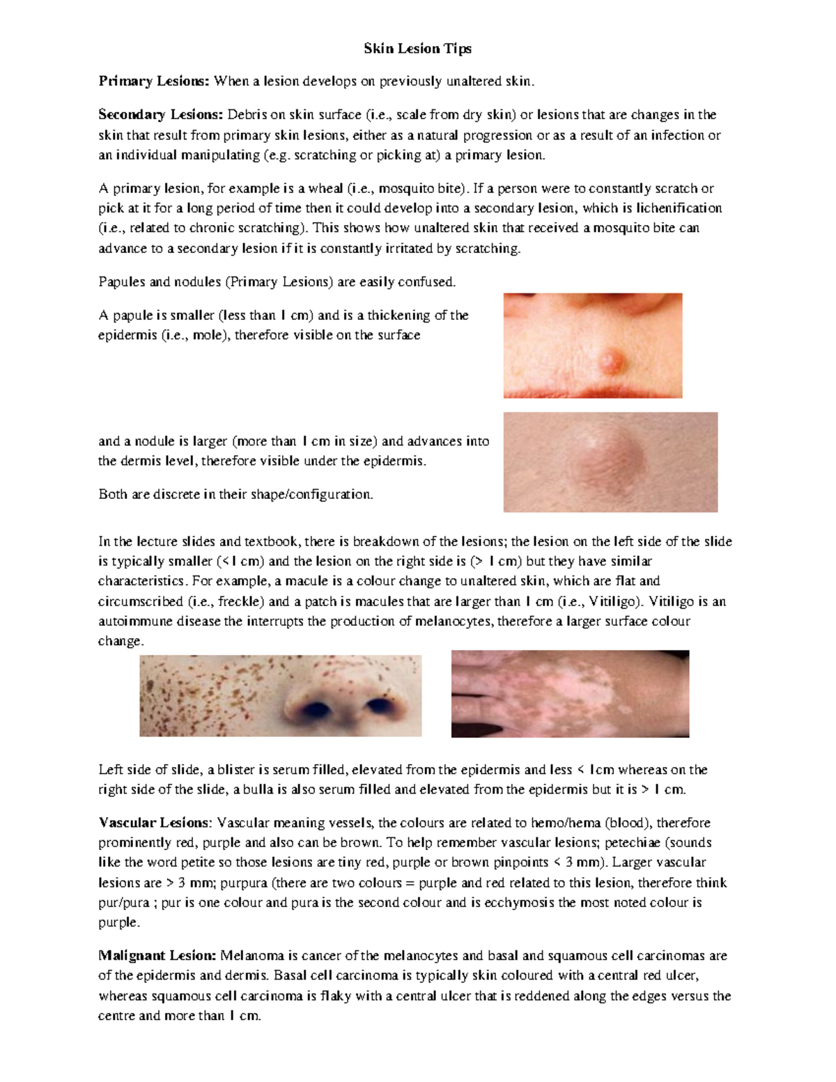 Skin Lesion Study Tips - Skin Lesion Tips Primary Lesions: When a ...
