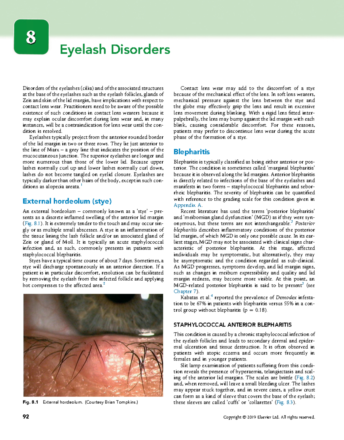 Eyelash Disorders Contact Lens Complications - 88 Eyelash Disorders ...
